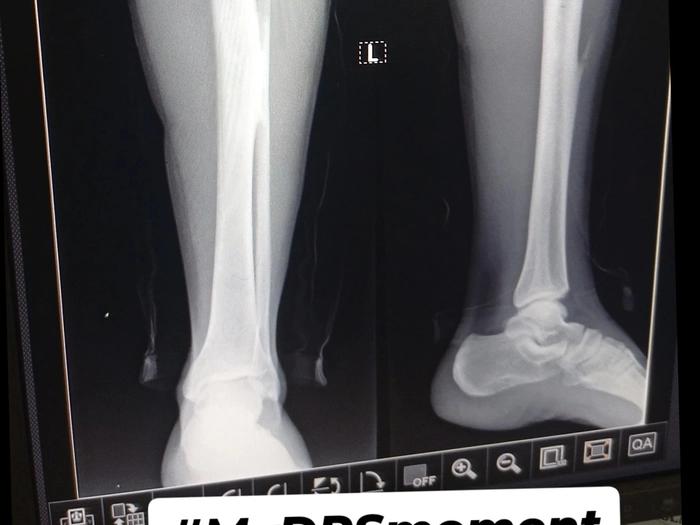 #MyDRSMoment leg scan